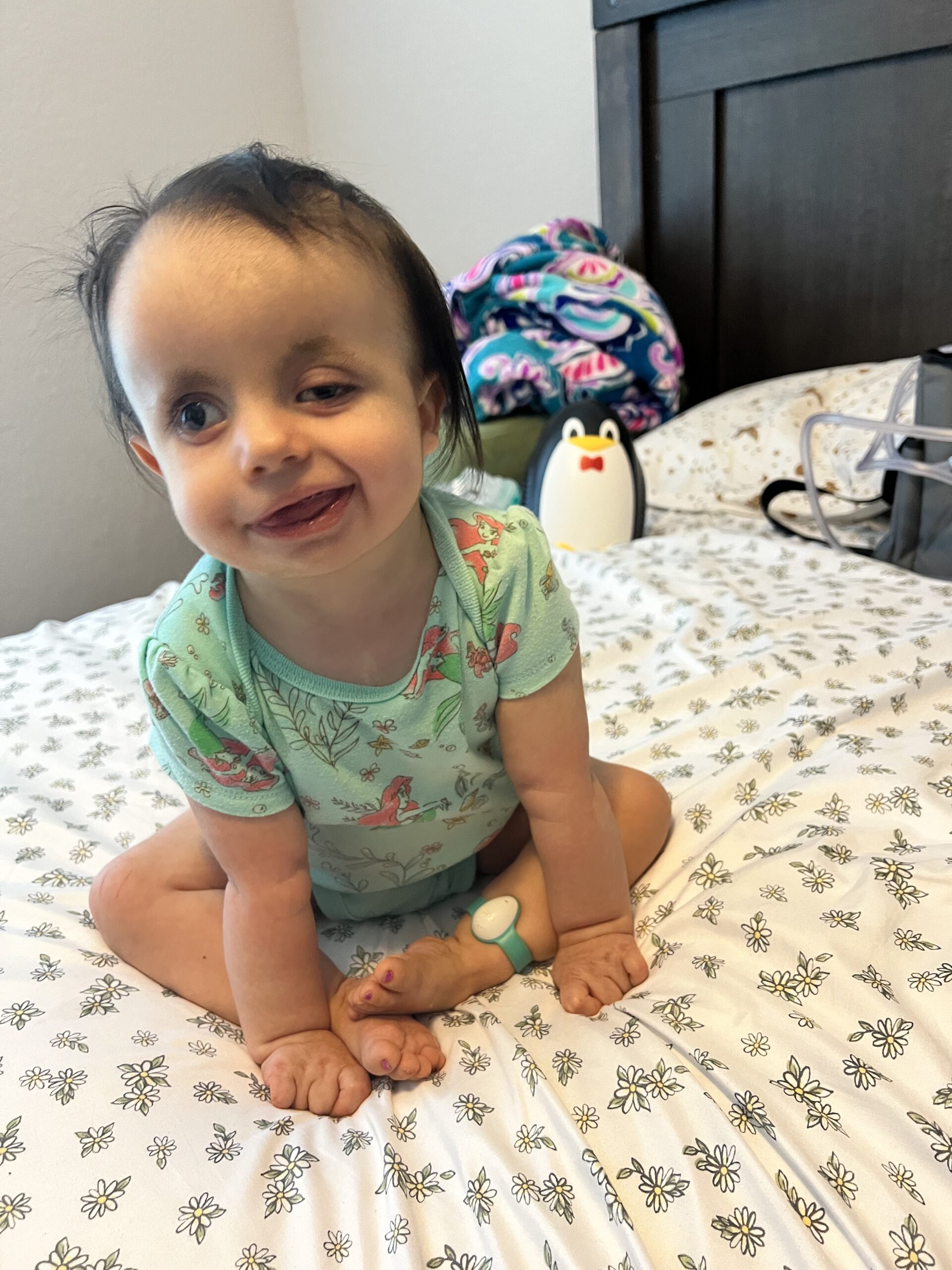 Olivia Full 2 Years Old Edwards Syndrome Association