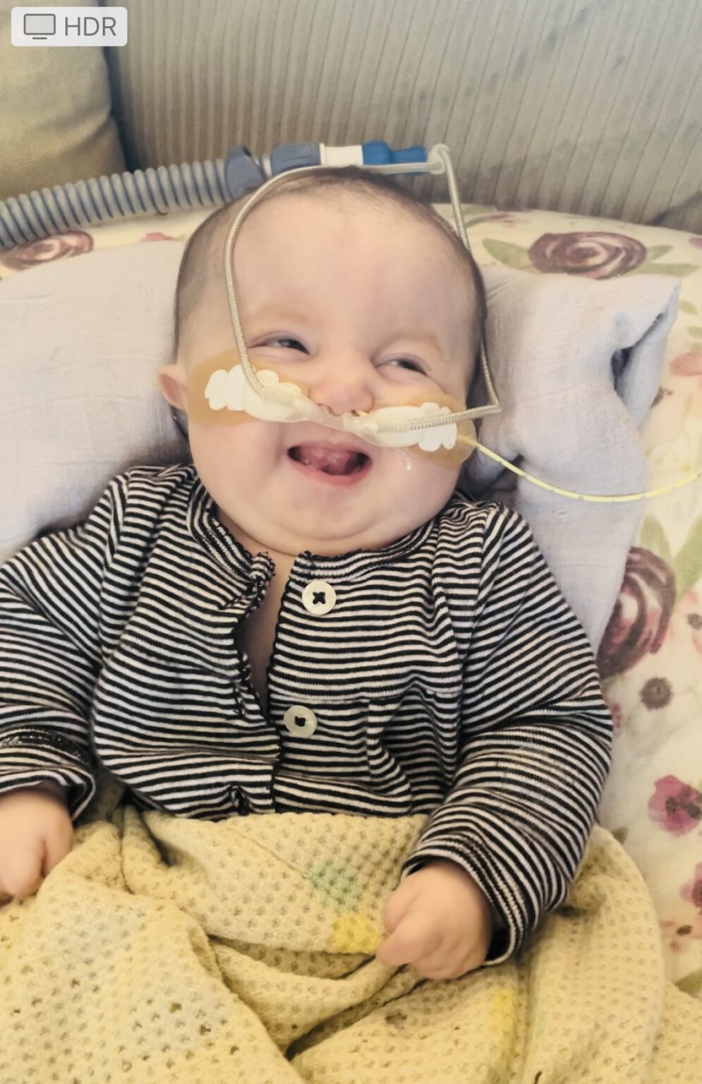 Thriving Trisomy 18 Children - Edwards Syndrome Association | Home
