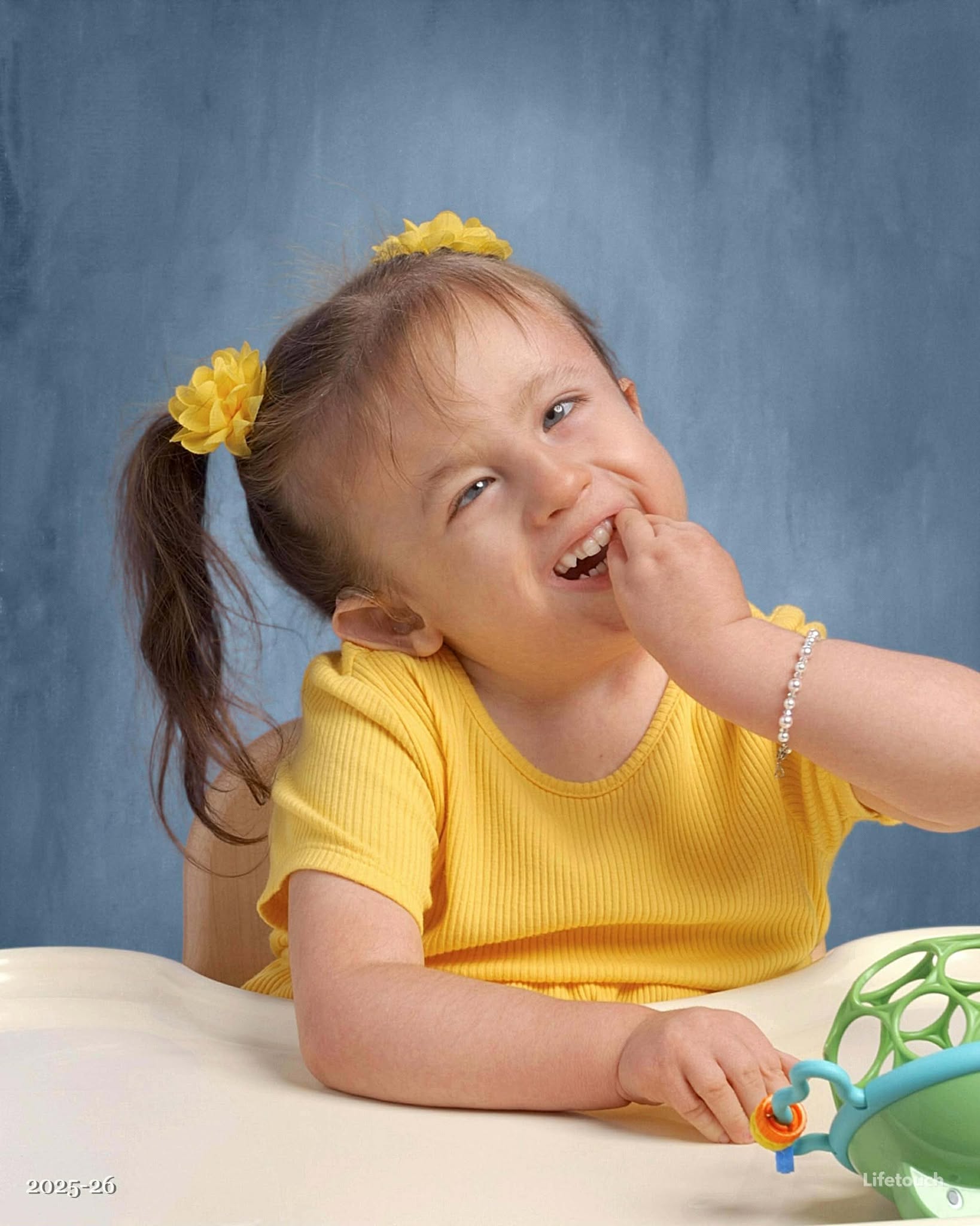 Diagnosing Trisomy 18 (Edwards Syndrome)